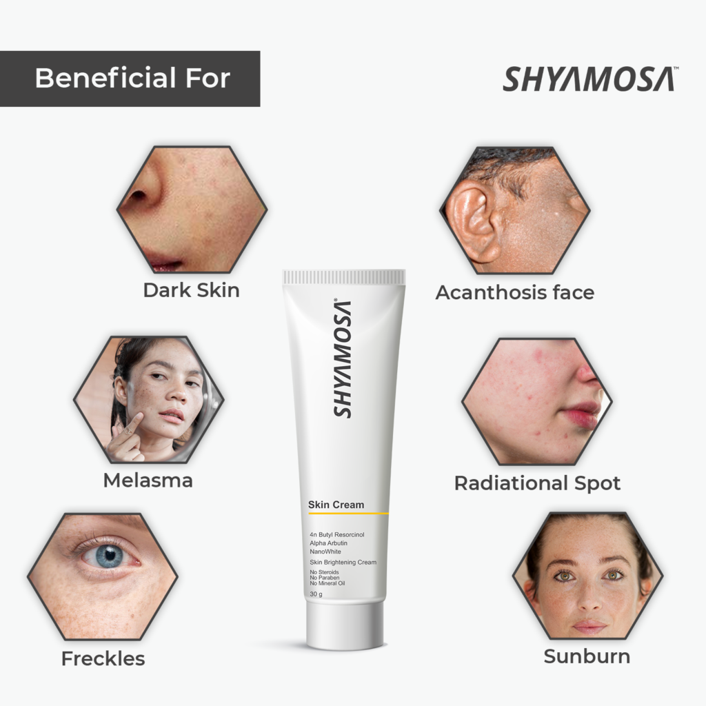 Shyamosa Skin Cream – Shyamosa